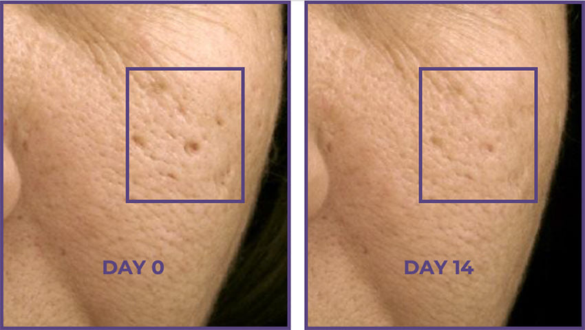 SYSTEM SKIN: Deep-tech for skin longevity – System Skin